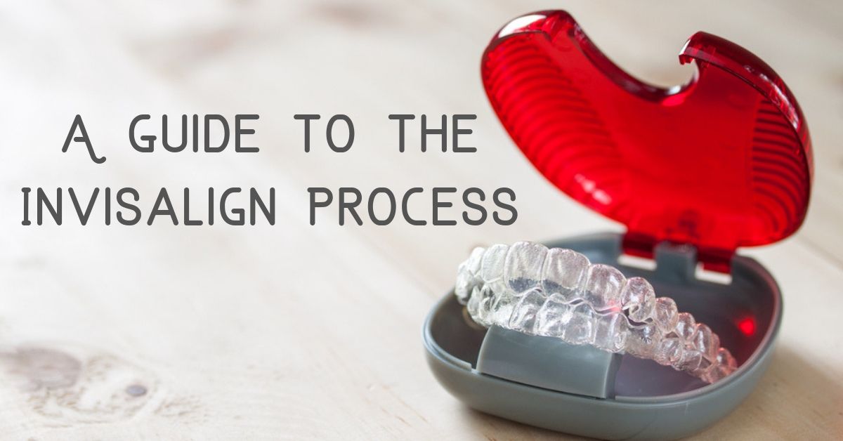 A Detailed Guide To The Invisalign Process